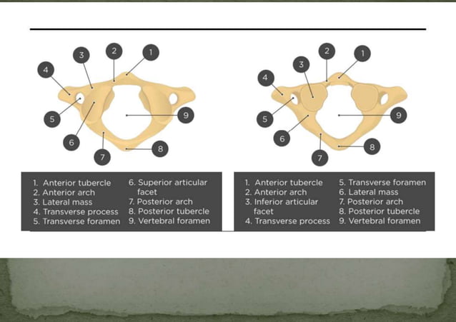 Vertebral column pathology , PPT, | PPTX