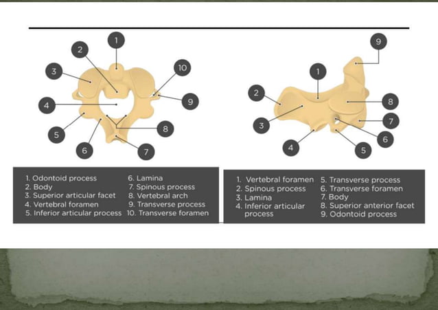 Vertebral column pathology , PPT, | PPTX