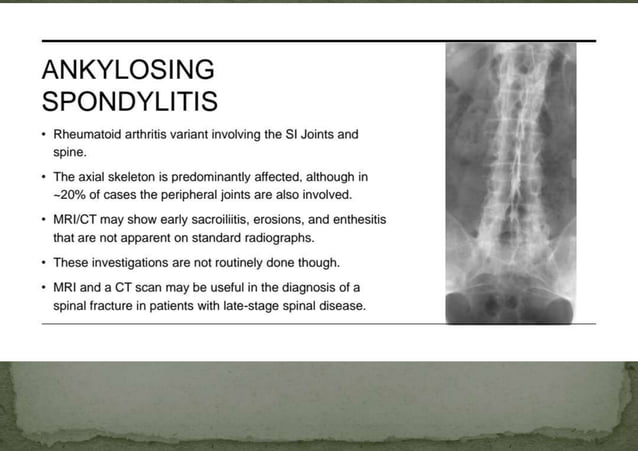 Vertebral column pathology , PPT, | PPTX