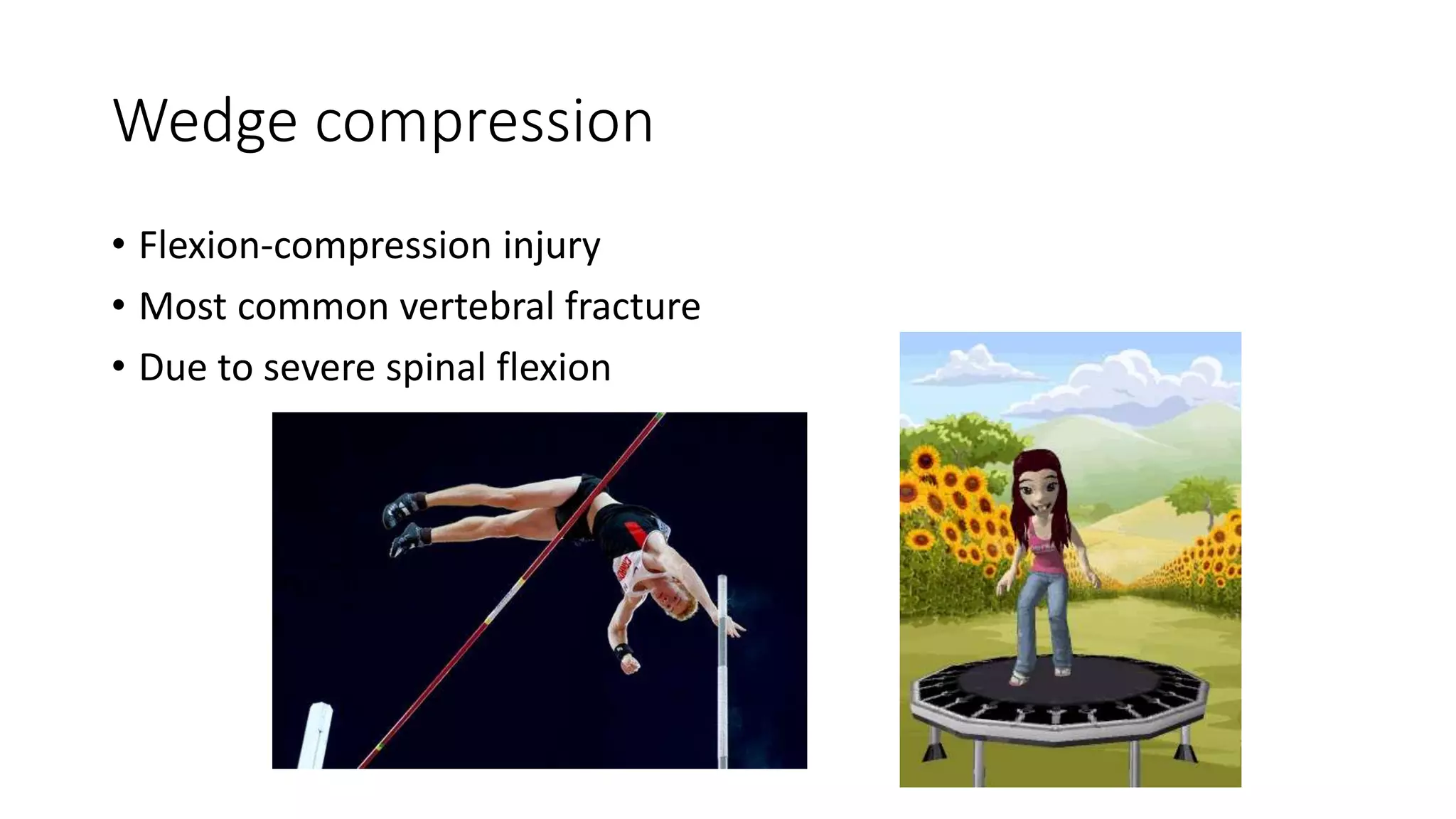 Vertebral Fracture and Spinal Cord Injury.pptx