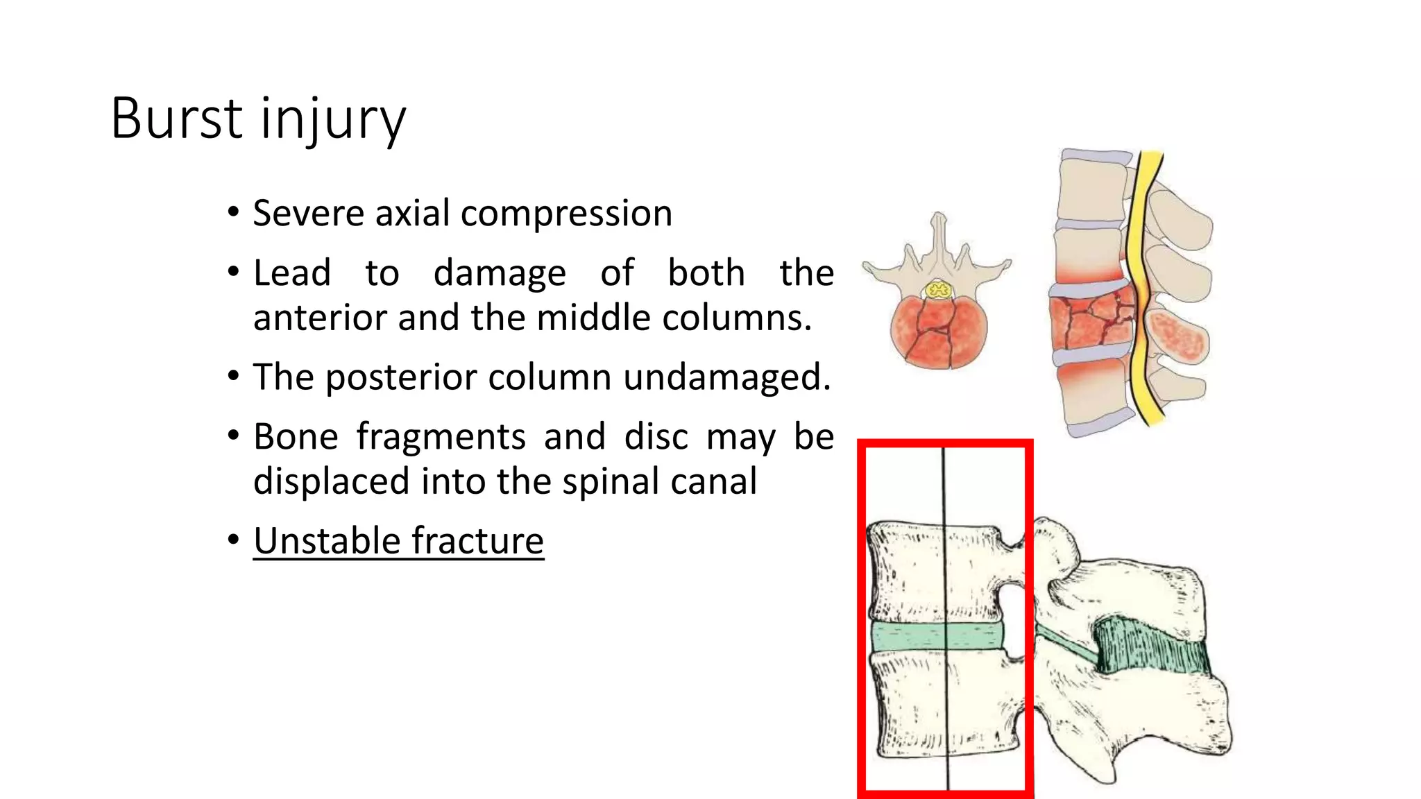Vertebral Fracture and Spinal Cord Injury.pptx