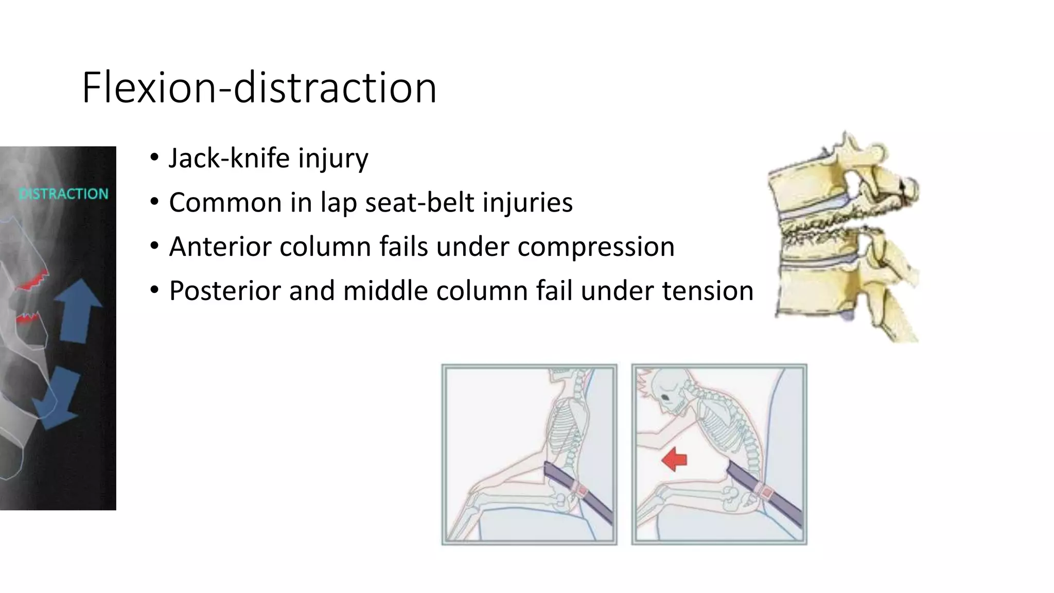 Vertebral Fracture and Spinal Cord Injury.pptx