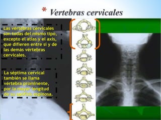 Vertebras cervicales.pptx