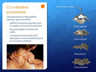 Vertebras cervicales | PPTX