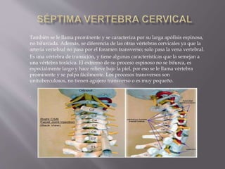 Vertebras cervicales 2 | PPTX