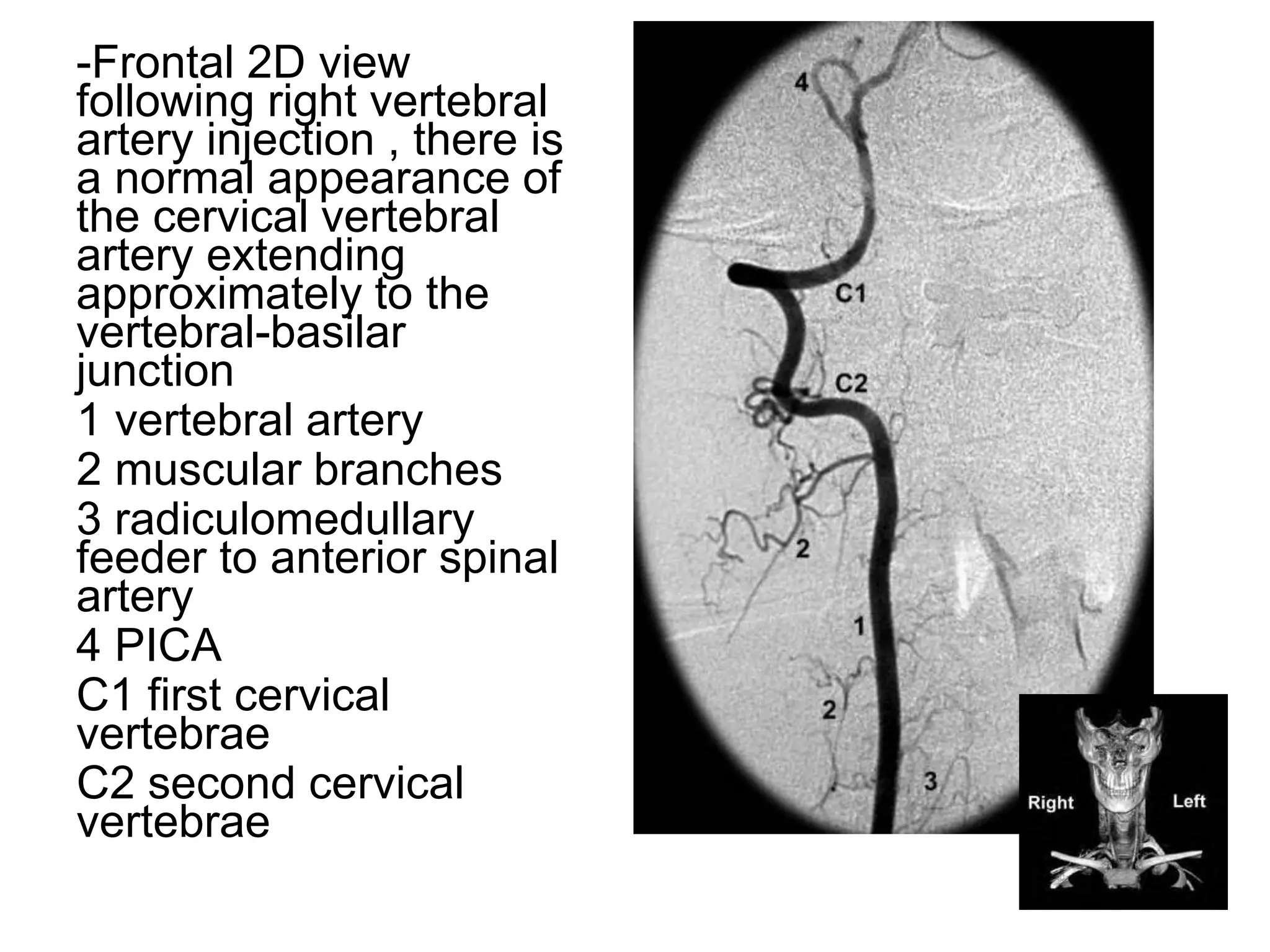 Anatomy of the posterior cerebral circulation | PPT