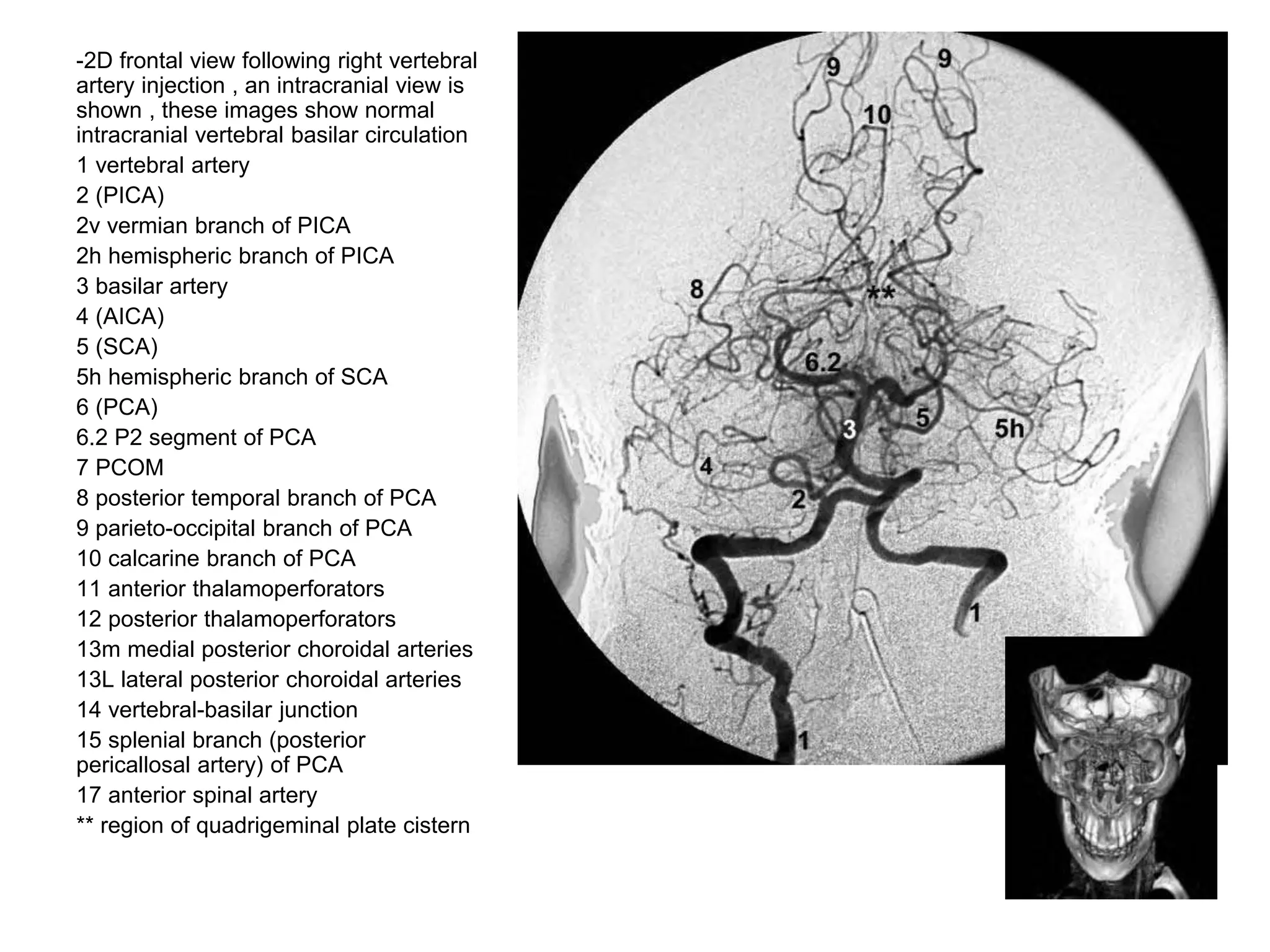 Anatomy of the posterior cerebral circulation | PPT