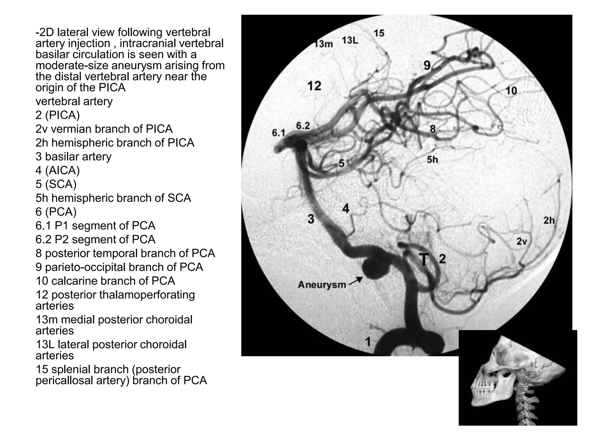 Anatomy of the posterior cerebral circulation | PPT