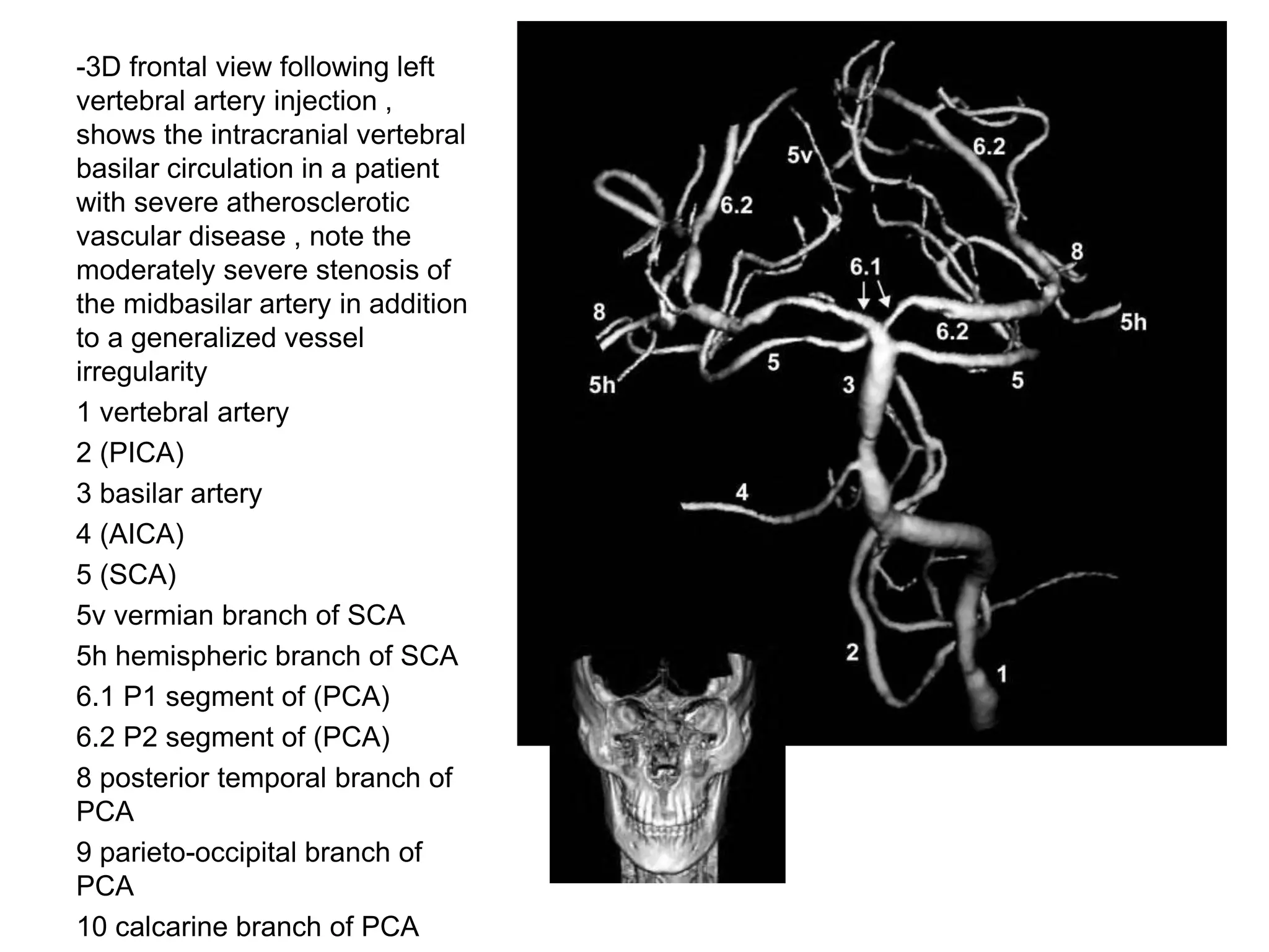 Anatomy of the posterior cerebral circulation | PPT