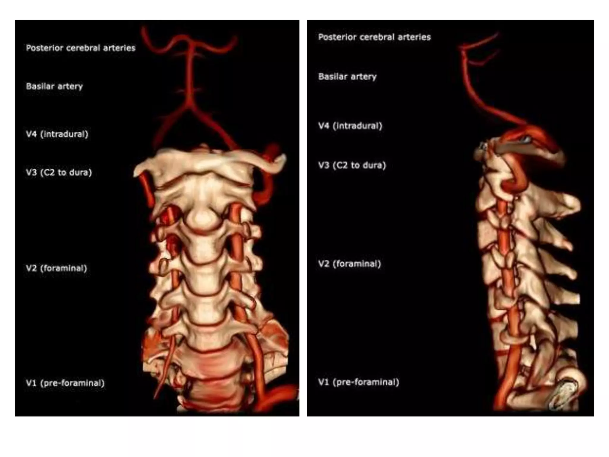 Anatomy of the posterior cerebral circulation | PPT