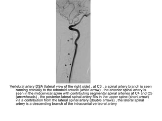 Anatomy of the posterior cerebral circulation | PPT