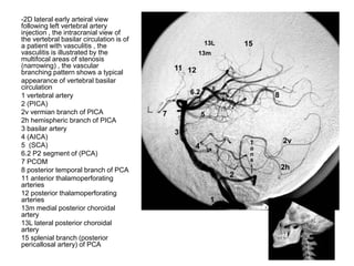 Anatomy of the posterior cerebral circulation | PPT