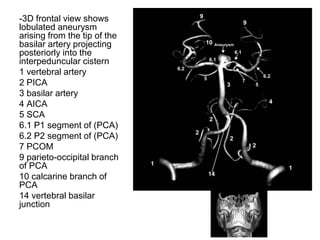 Anatomy of the posterior cerebral circulation | PPT