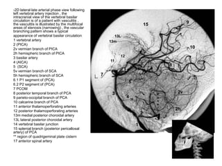Anatomy of the posterior cerebral circulation | PPT