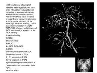 Anatomy of the posterior cerebral circulation | PPT