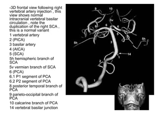 Anatomy of the posterior cerebral circulation | PPT