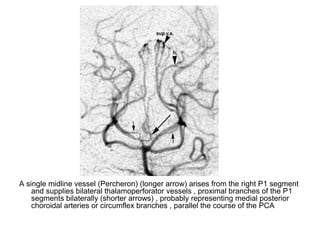 Anatomy of the posterior cerebral circulation | PPT