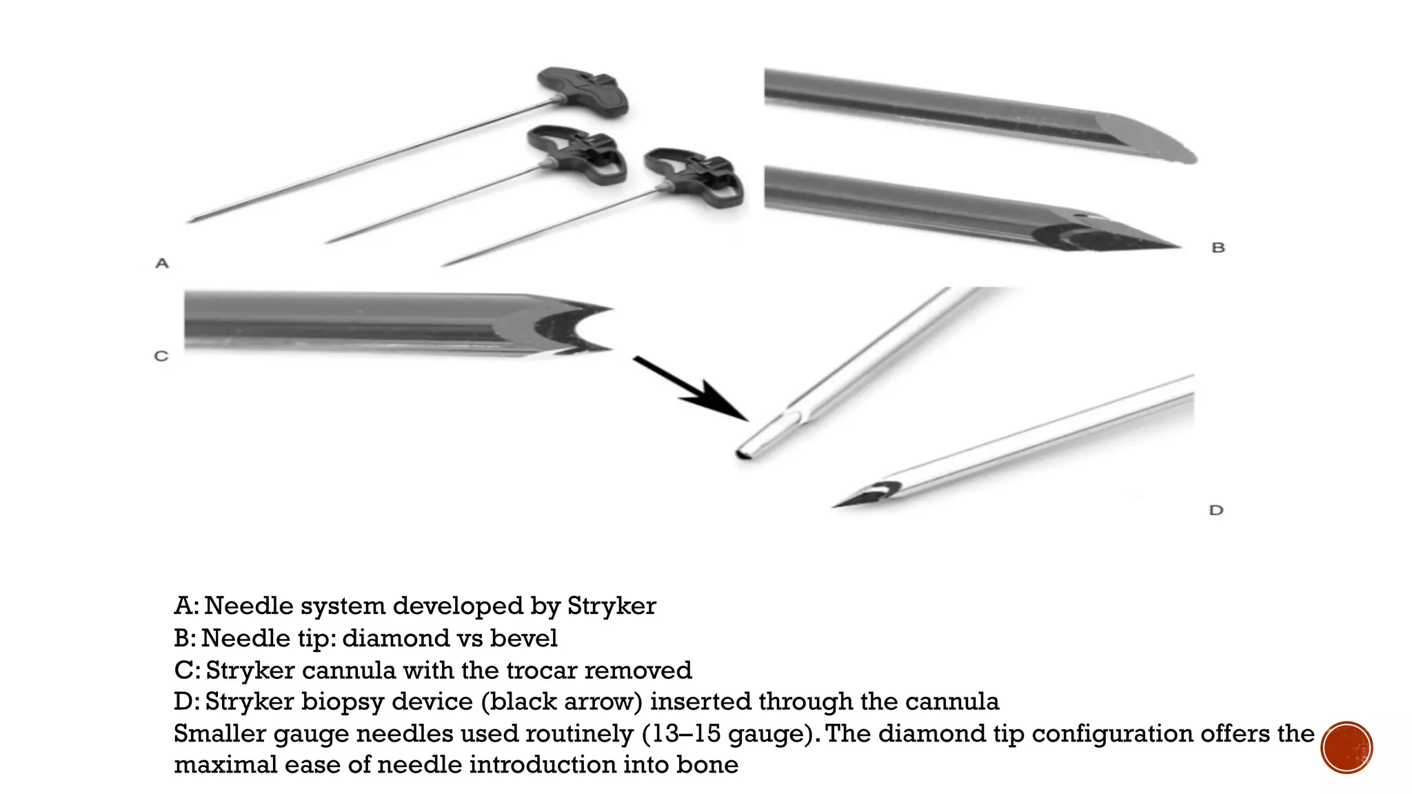 Vertebroplasty and Kyphoplasty | PDF
