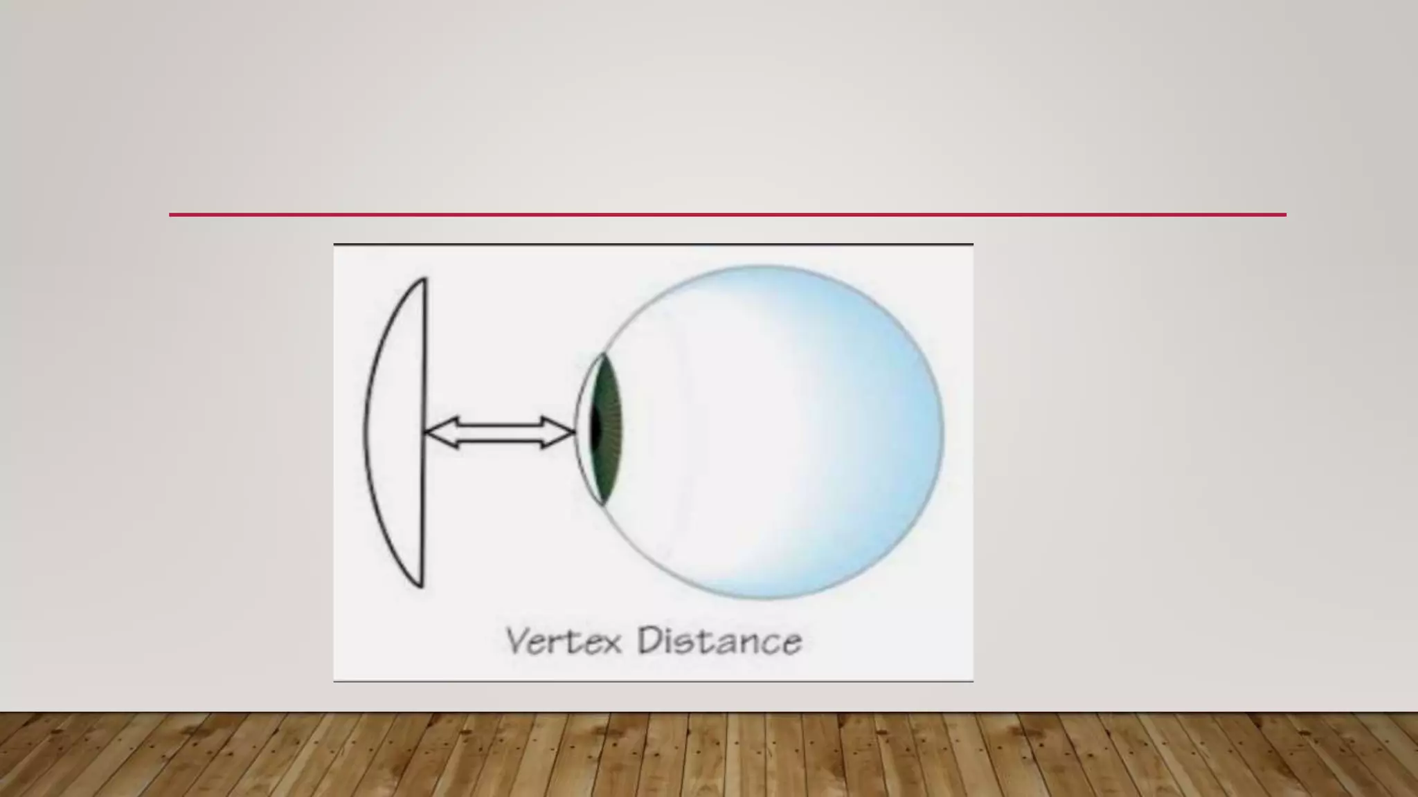 Vertex distance and power | PPTX