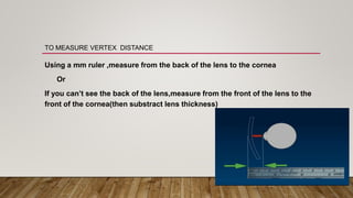 Vertex distance and power | PPTX