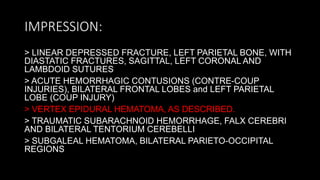 VERTEX EPIDURAL HEMATOMA 1.17.1.42.CT.pptx