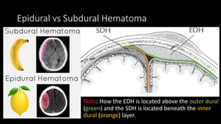 VERTEX EPIDURAL HEMATOMA 1.17.1.42.CT.pptx