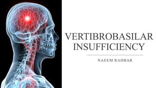Vertebrobasilar Insufficiency (VBI) – Causes, Symptoms, Diagnosis ...
