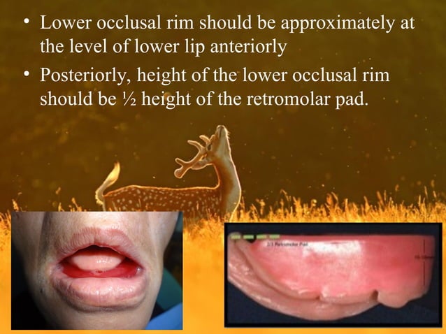 Vertical-Jaw-relations-Dr.-K.-Krishna-Kishore.ppt