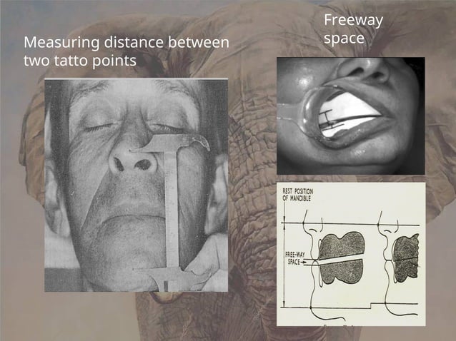 Vertical-Jaw-relations-Dr.-K.-Krishna-Kishore.ppt