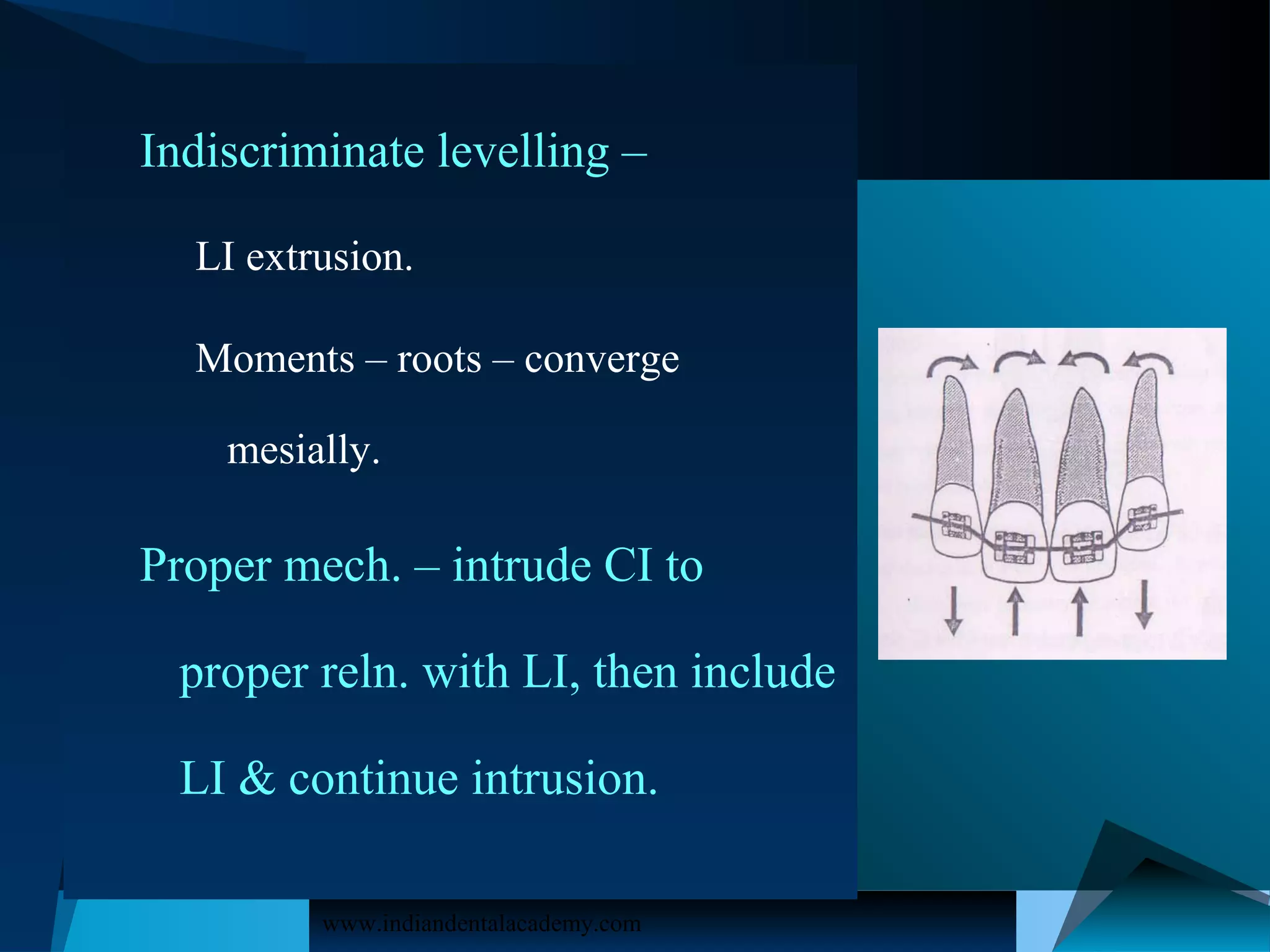 Vertical control in straight wire technique , intrusion mechanics | PPT