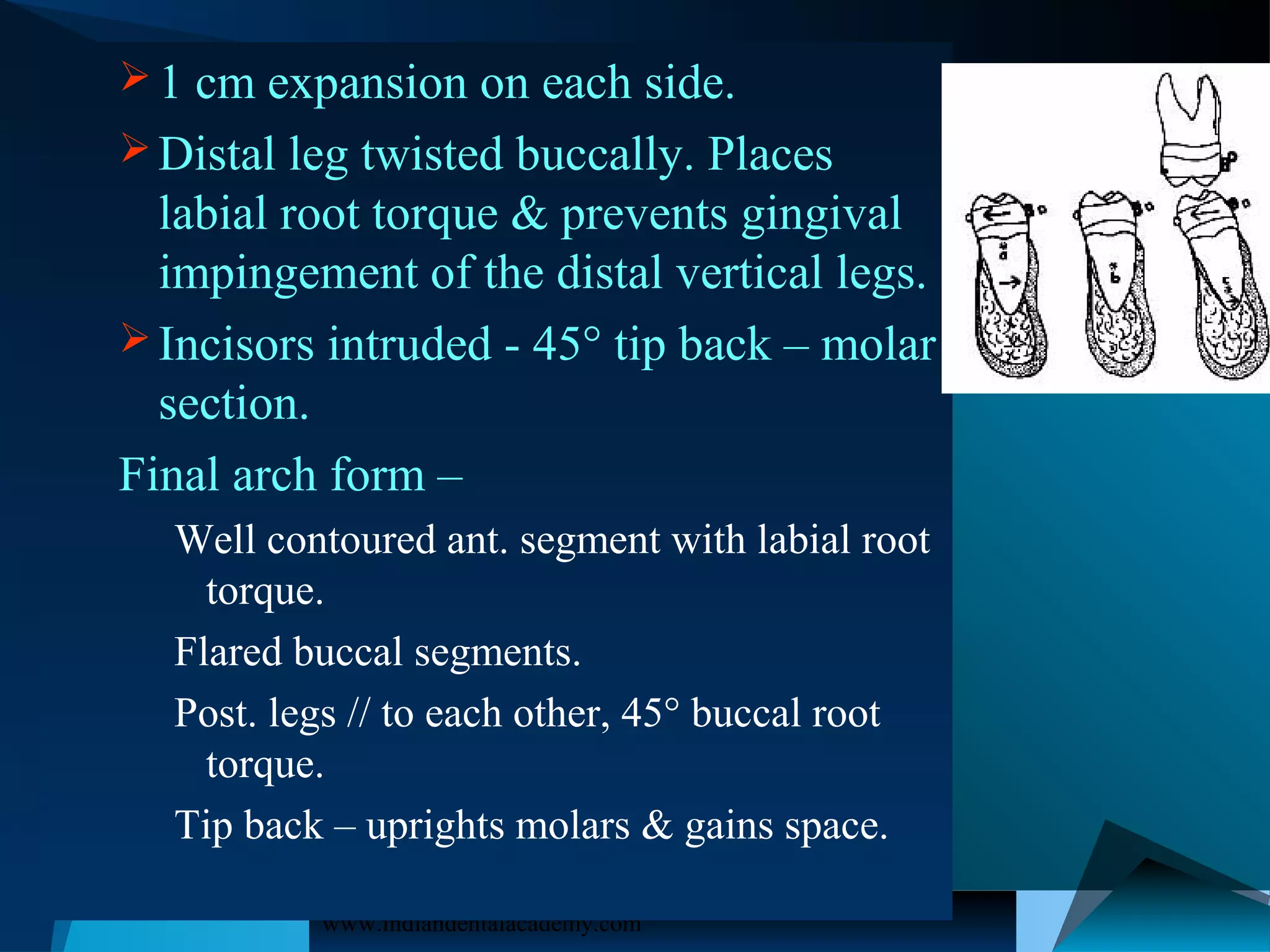 Vertical control in straight wire technique , intrusion mechanics | PPT