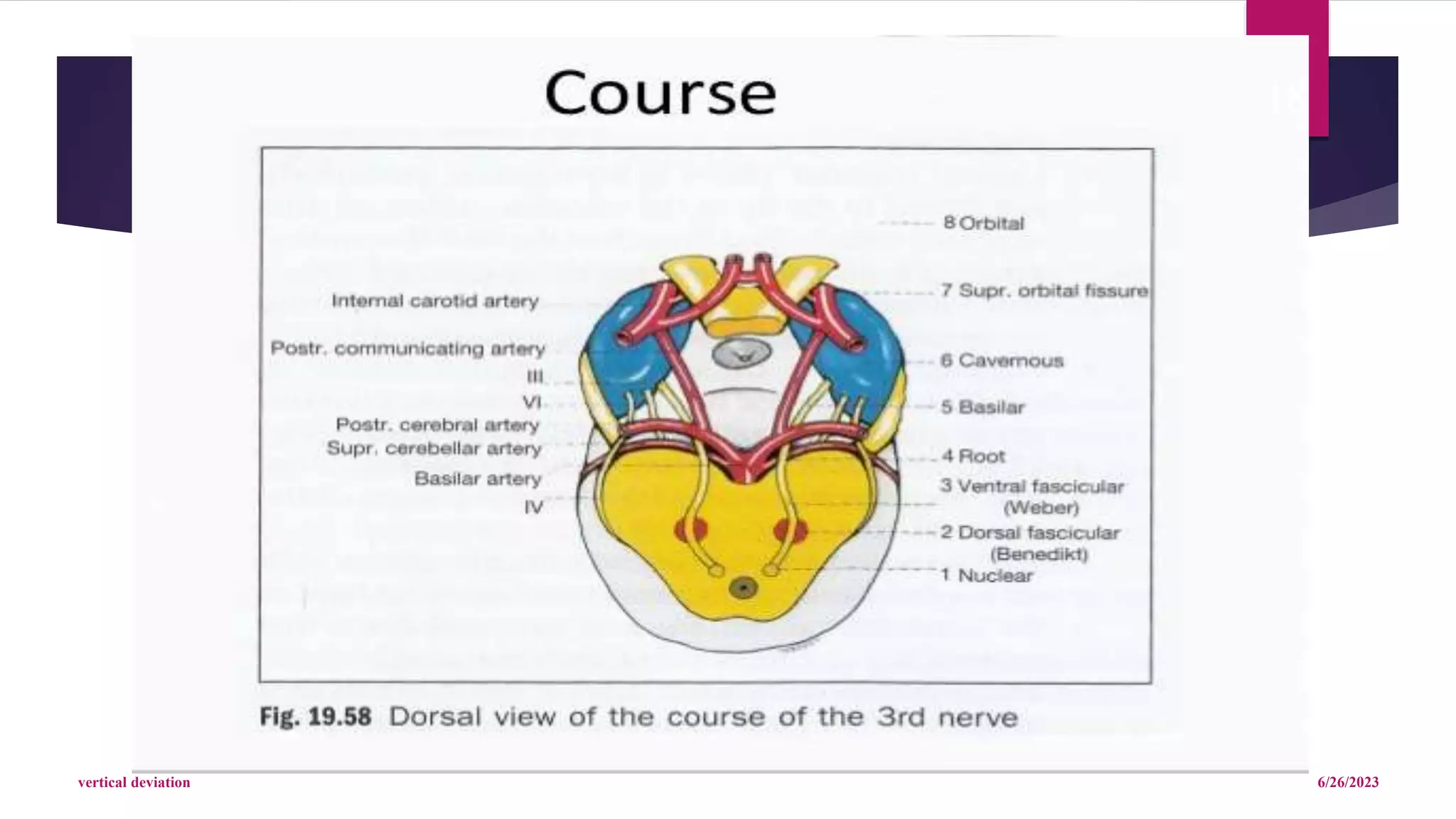 Vertical Deviation.pptx