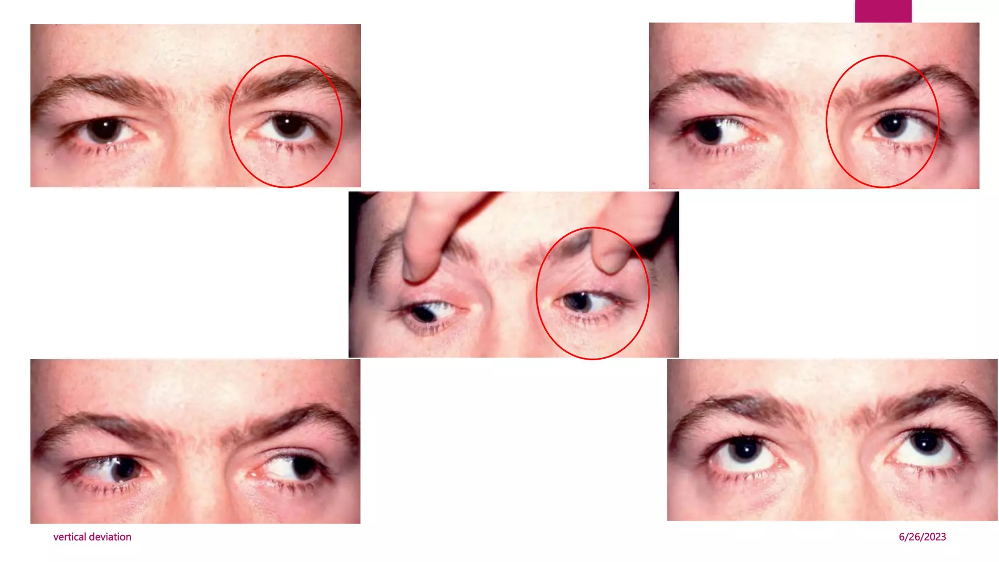 Vertical Deviation.pptx