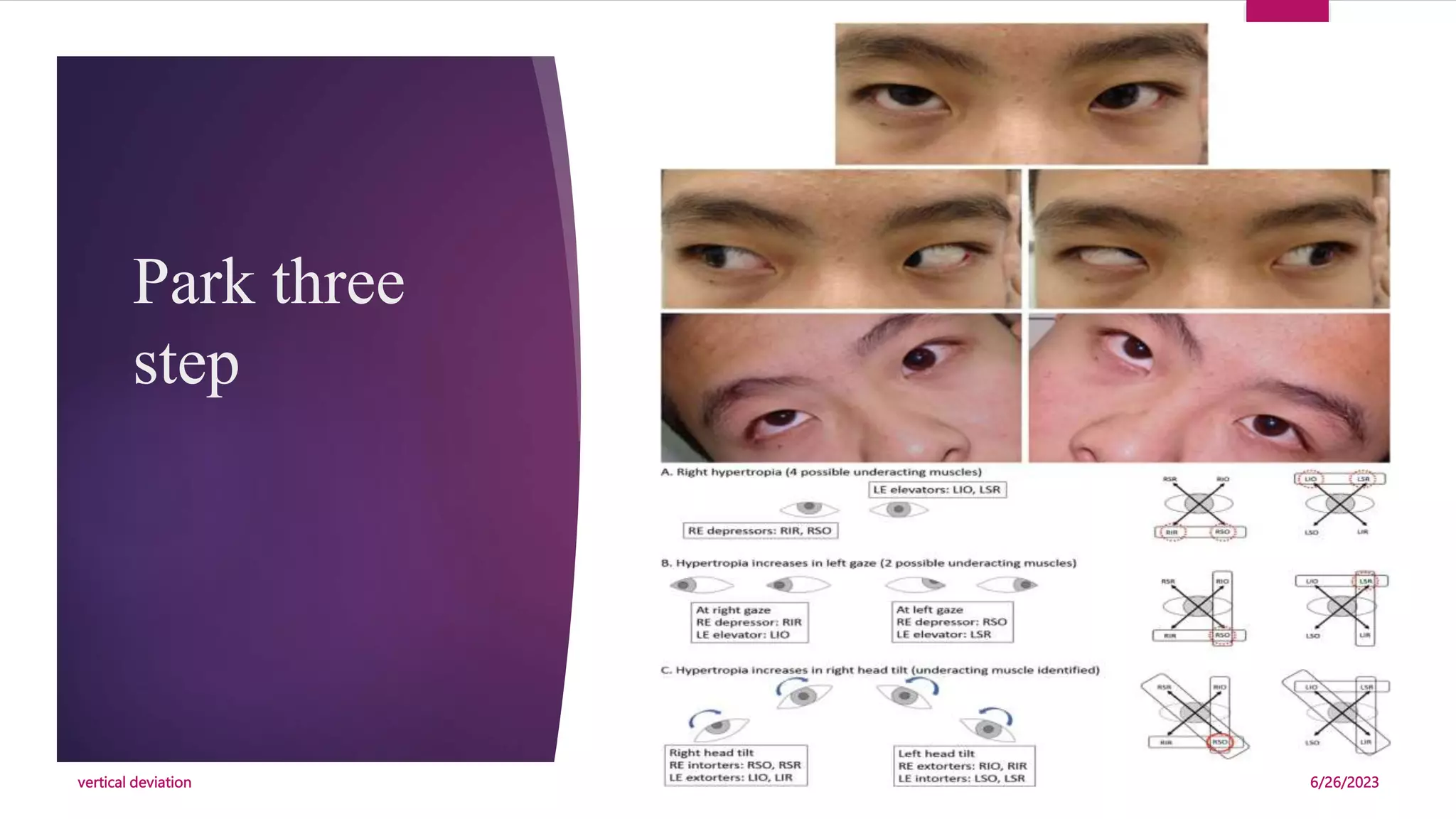 Vertical Deviation.pptx