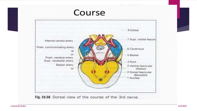 Vertical Deviation.pptx