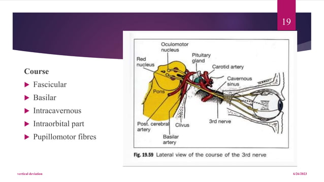Vertical Deviation.pptx