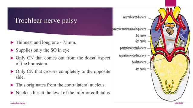 Vertical Deviation.pptx