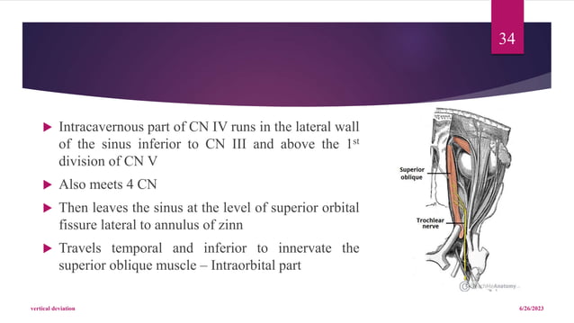 Vertical Deviation.pptx
