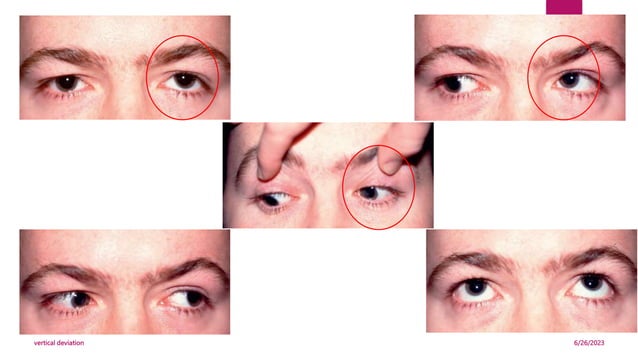 Vertical Deviation.pptx