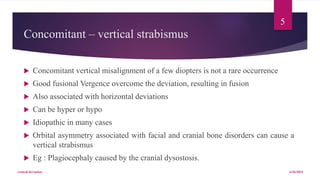 Vertical Deviation.pptx