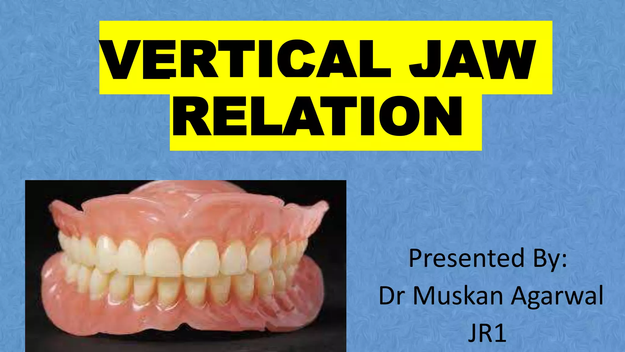 VERTICAL JAW RELATION.pptx