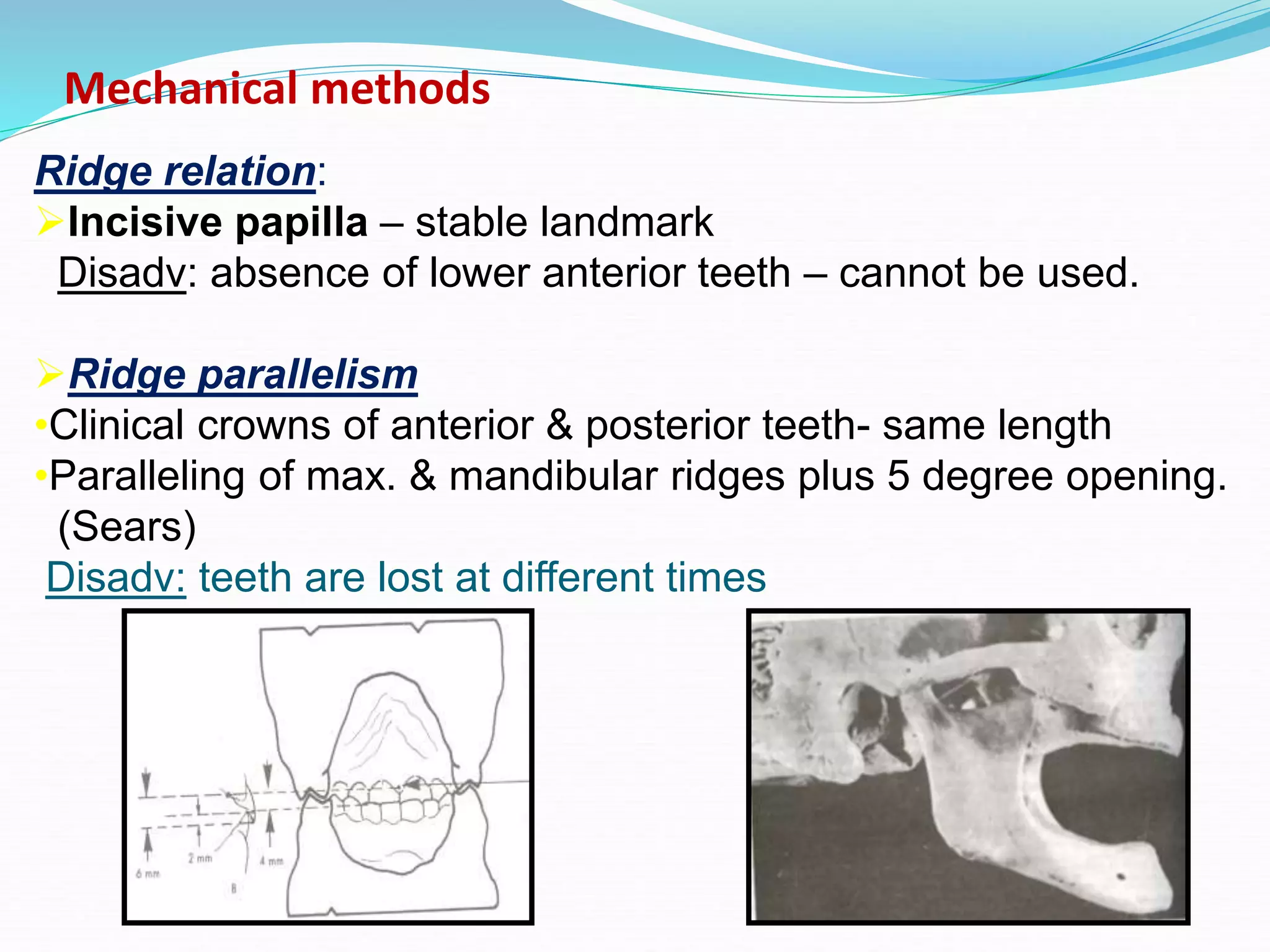 vertical jaw relation.ppt