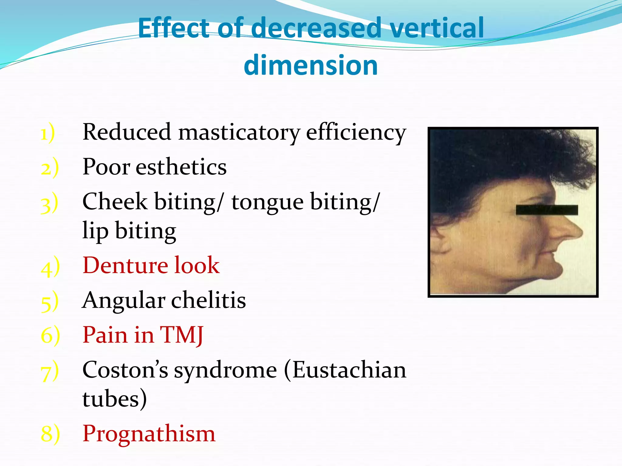 vertical jaw relation.ppt