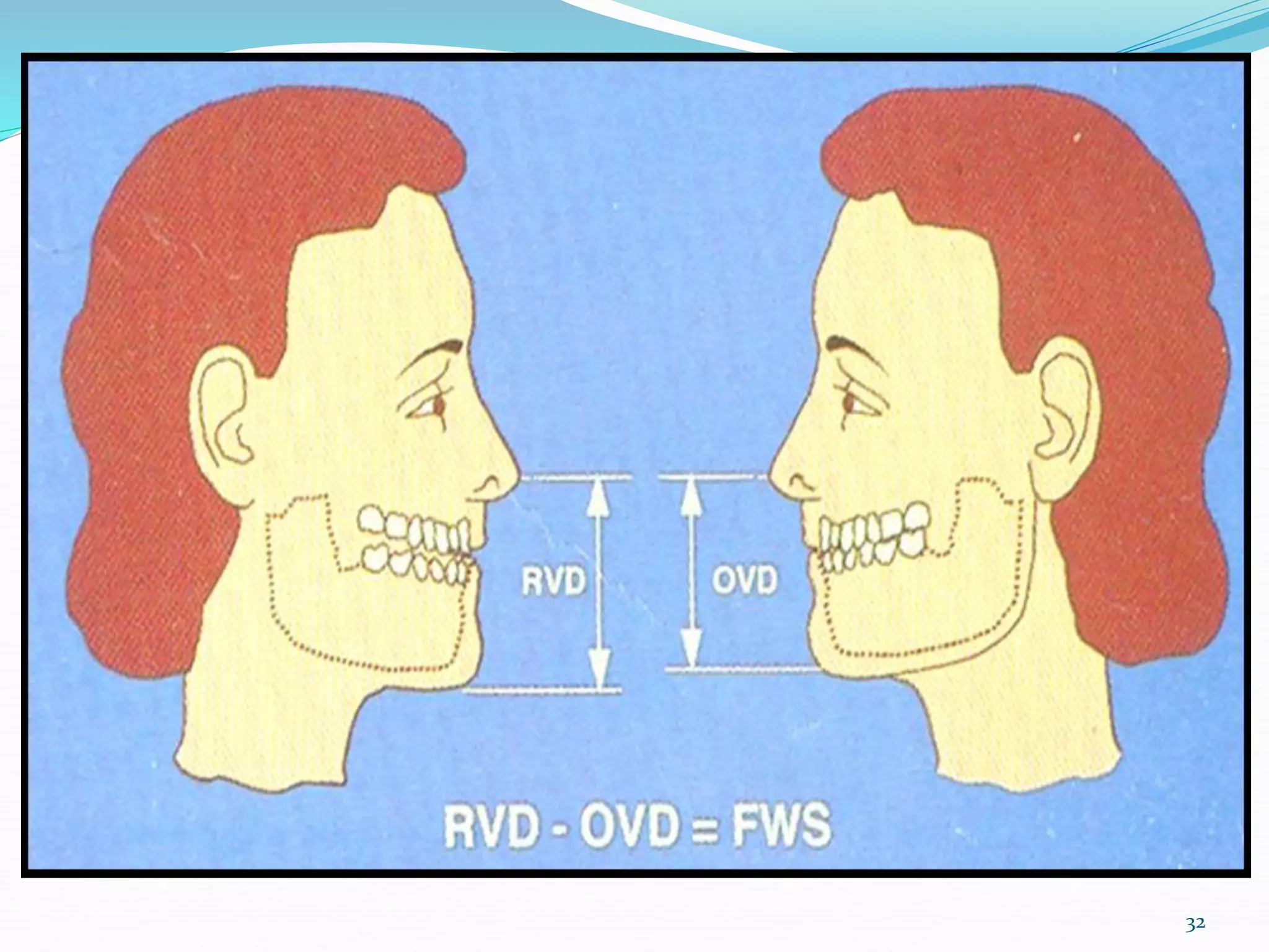 vertical jaw relation.ppt