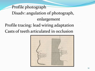 vertical jaw relation.ppt