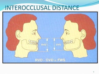 vertical jaw relation.ppt