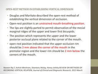 Vertical jaw relation | PPTX
