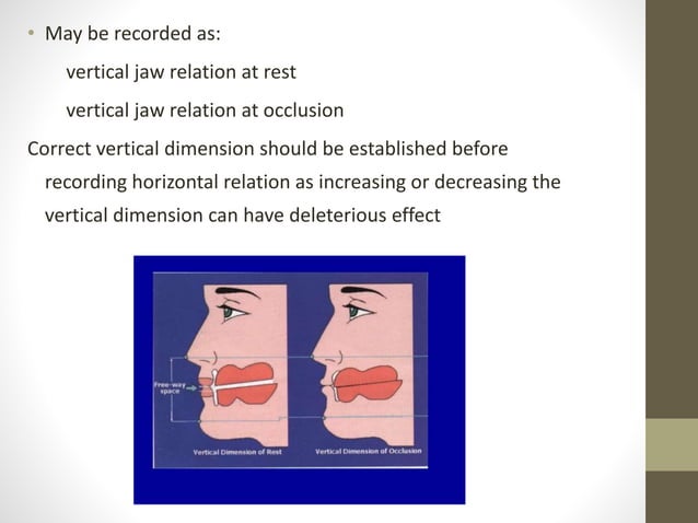 Vertical jaw relation | PPTX