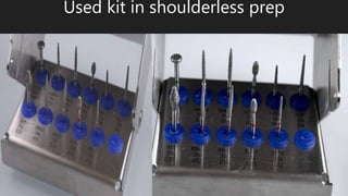 Vertical preparation | PPTX