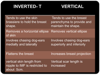 VERTICAL REDUCTION MAMMOPLASTY.pptx